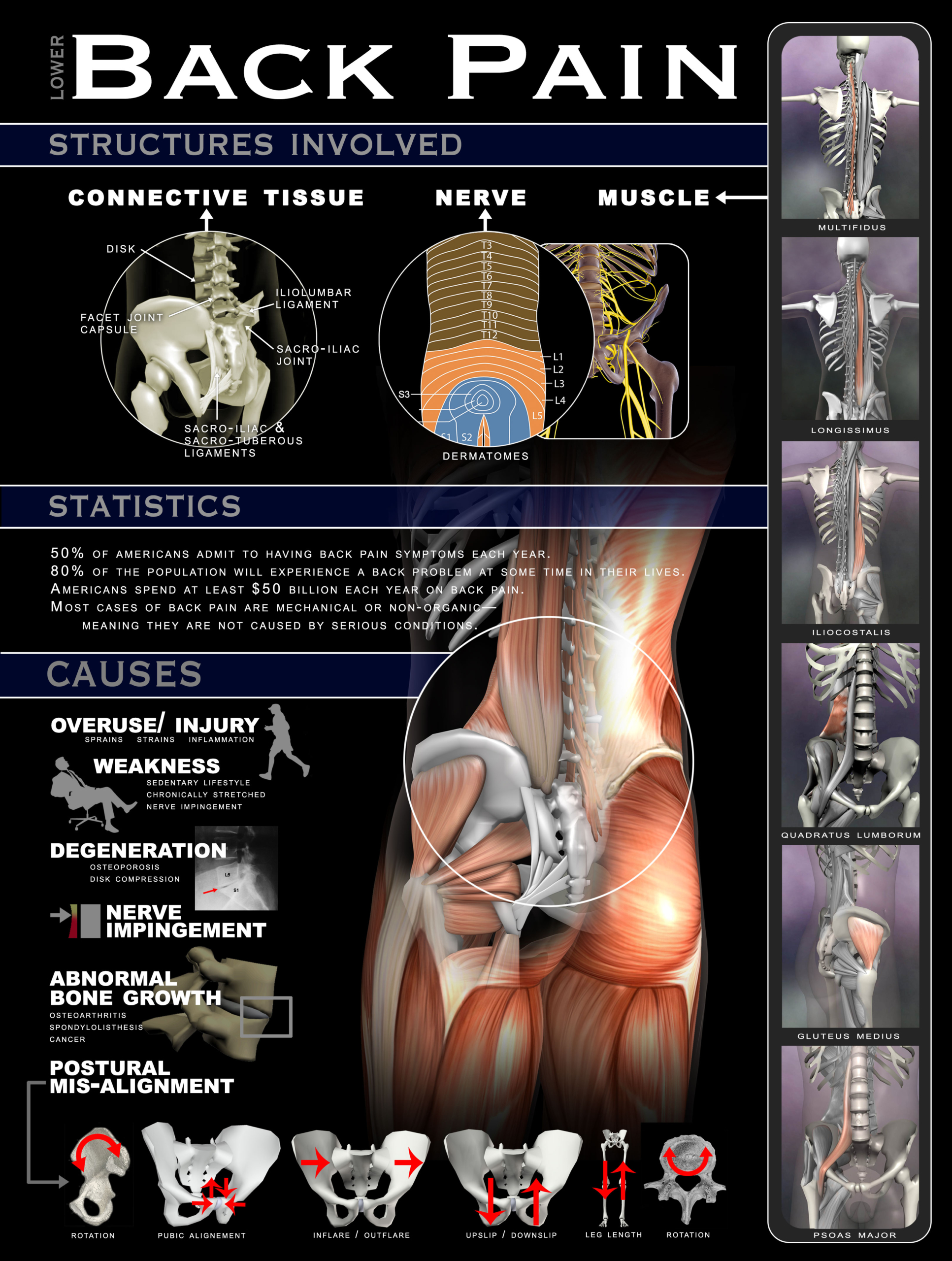 Human Anatomy Back Pain
