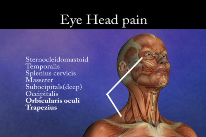 Eye and Head Pain - Real Bodywork