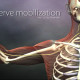 Nerve Mobilization for the arm DVD video - Real Bodywork