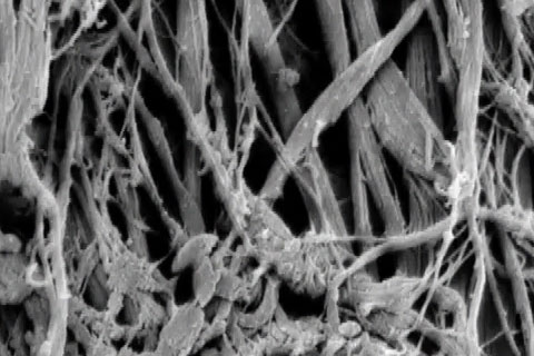 myofascial-release-anatomy-of-fascia - Real Bodywork